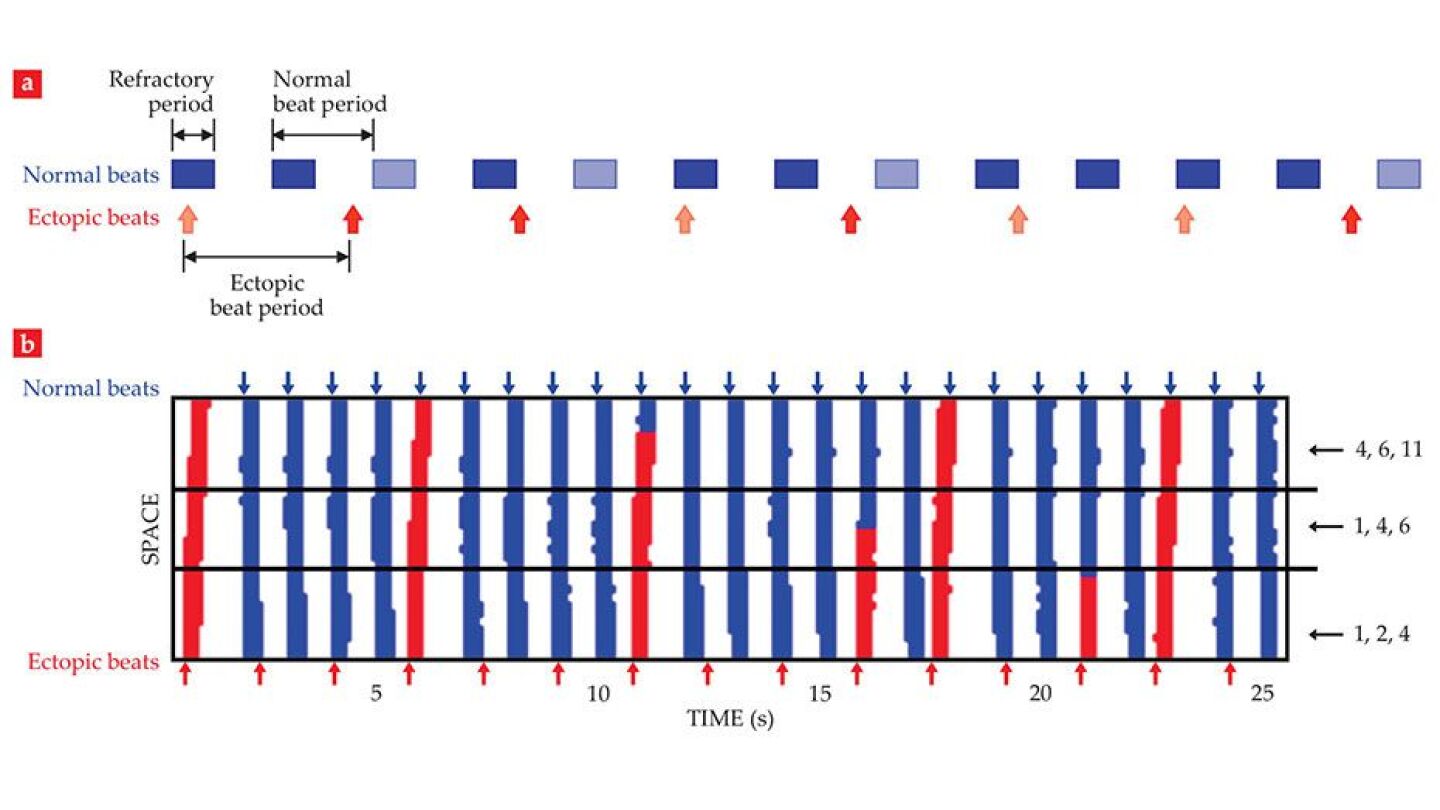 pacemaker and ectopic beats