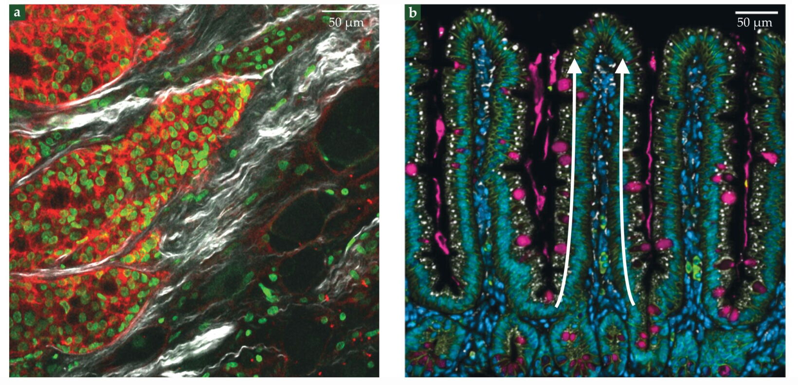 Living cells on the move - Physics Today